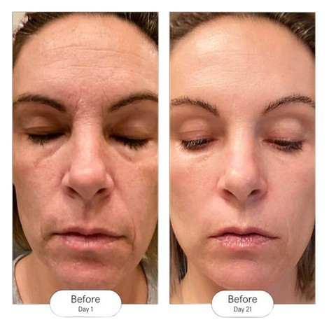 Sola Wave Red Light Skincare Device and cable - Skin care